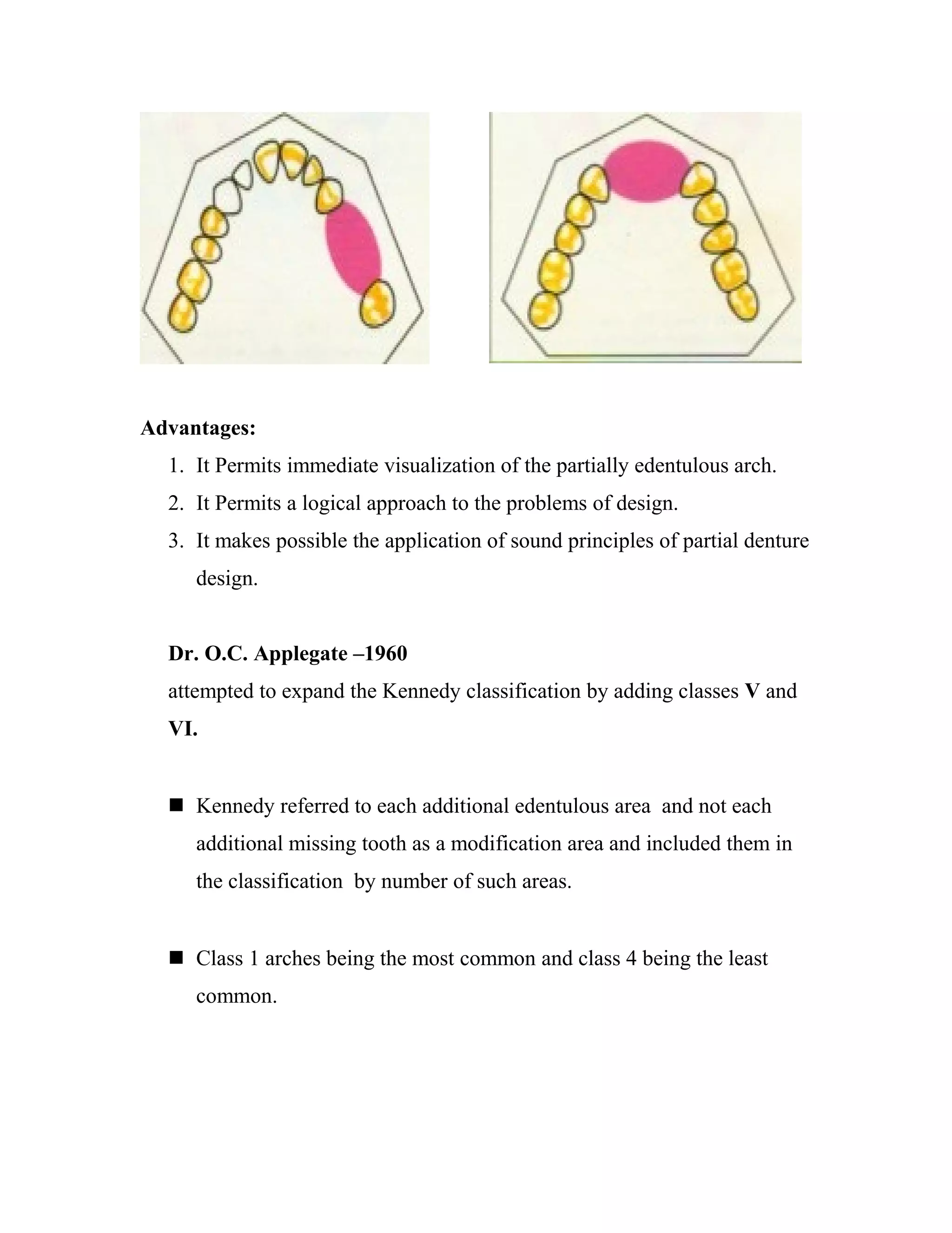 Classification of RPD/cosmetic dentistry course by Indian dental ...