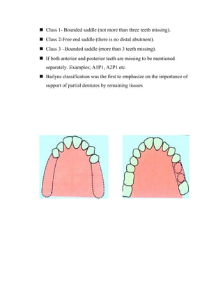 Classification of RPD/cosmetic dentistry course by Indian dental ...