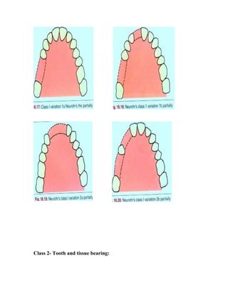Classification of RPD/cosmetic dentistry course by Indian dental ...