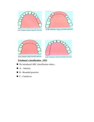 Classification of RPD/cosmetic dentistry course by Indian dental ...