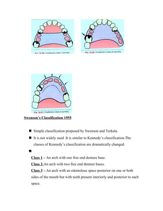 Classification of RPD/cosmetic dentistry course by Indian dental ...