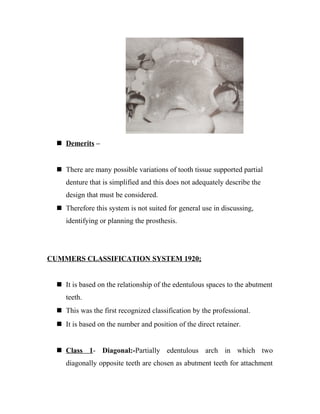 Classification of RPD/cosmetic dentistry course by Indian dental ...
