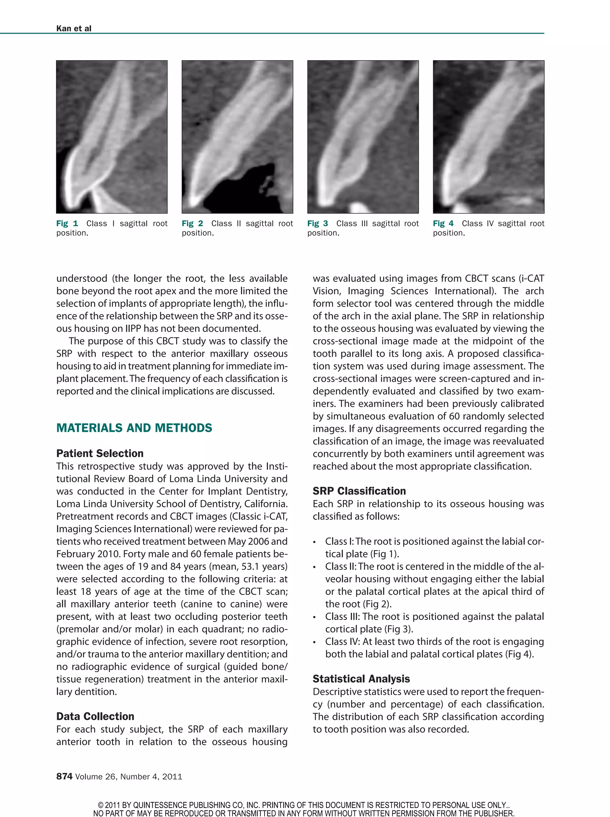 Classification of sagittal root position in relation to the anterior ...
