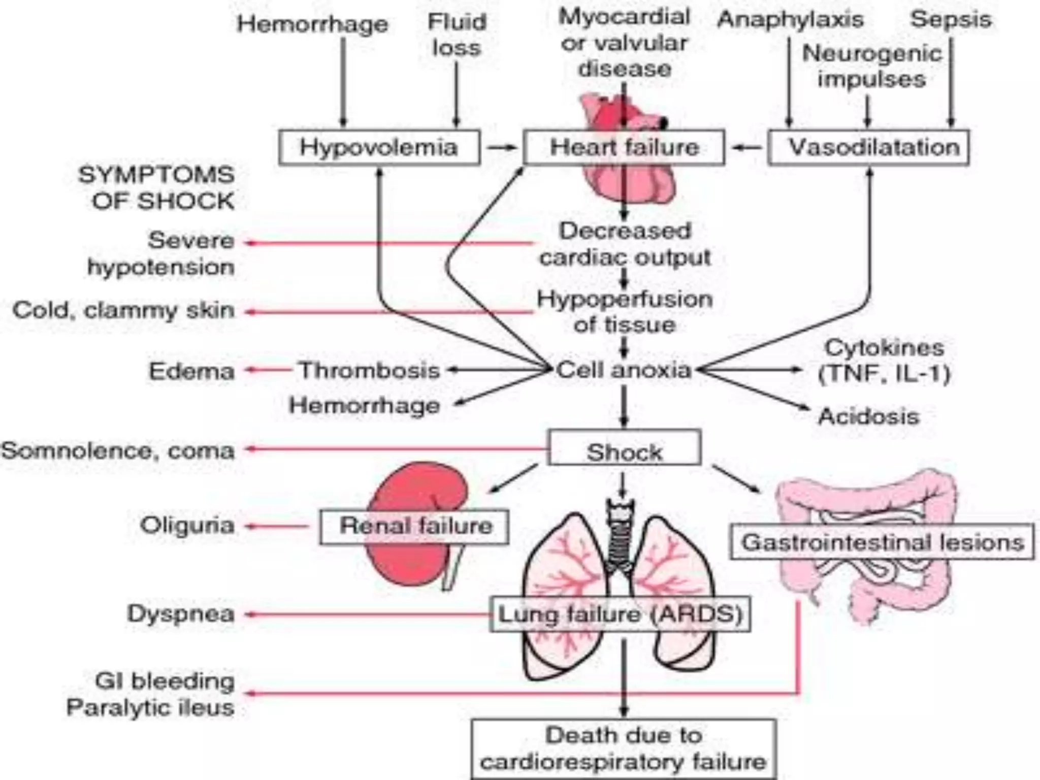 Classification of shock | PPTX