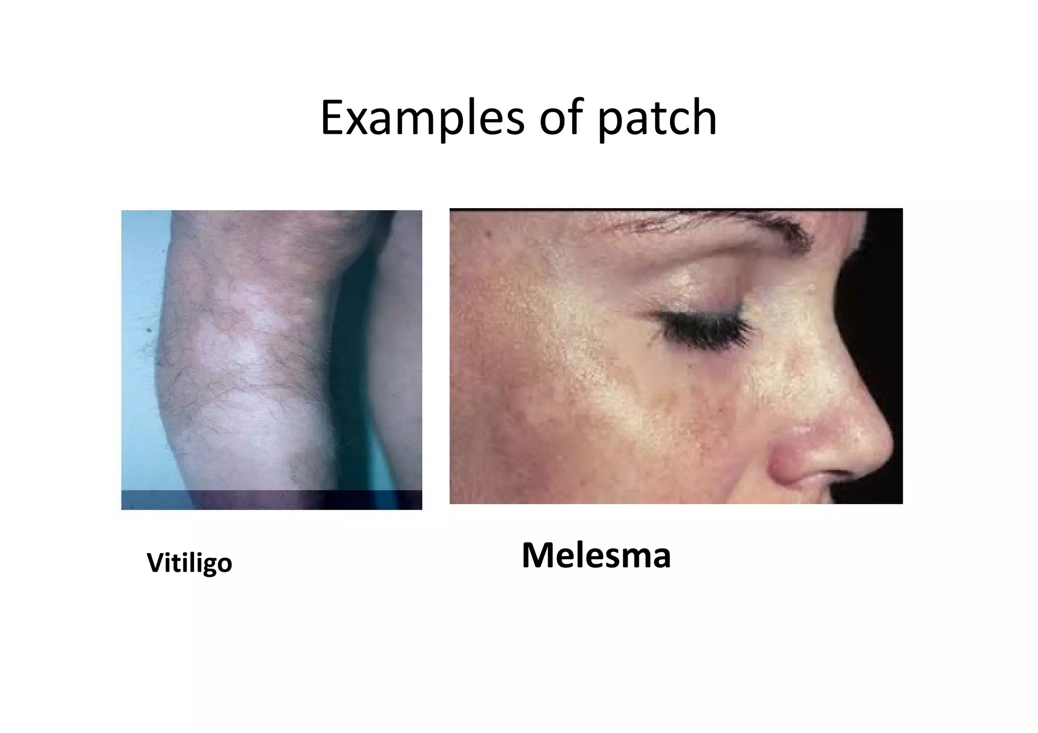 Classification of skin lesions pdf | PDF