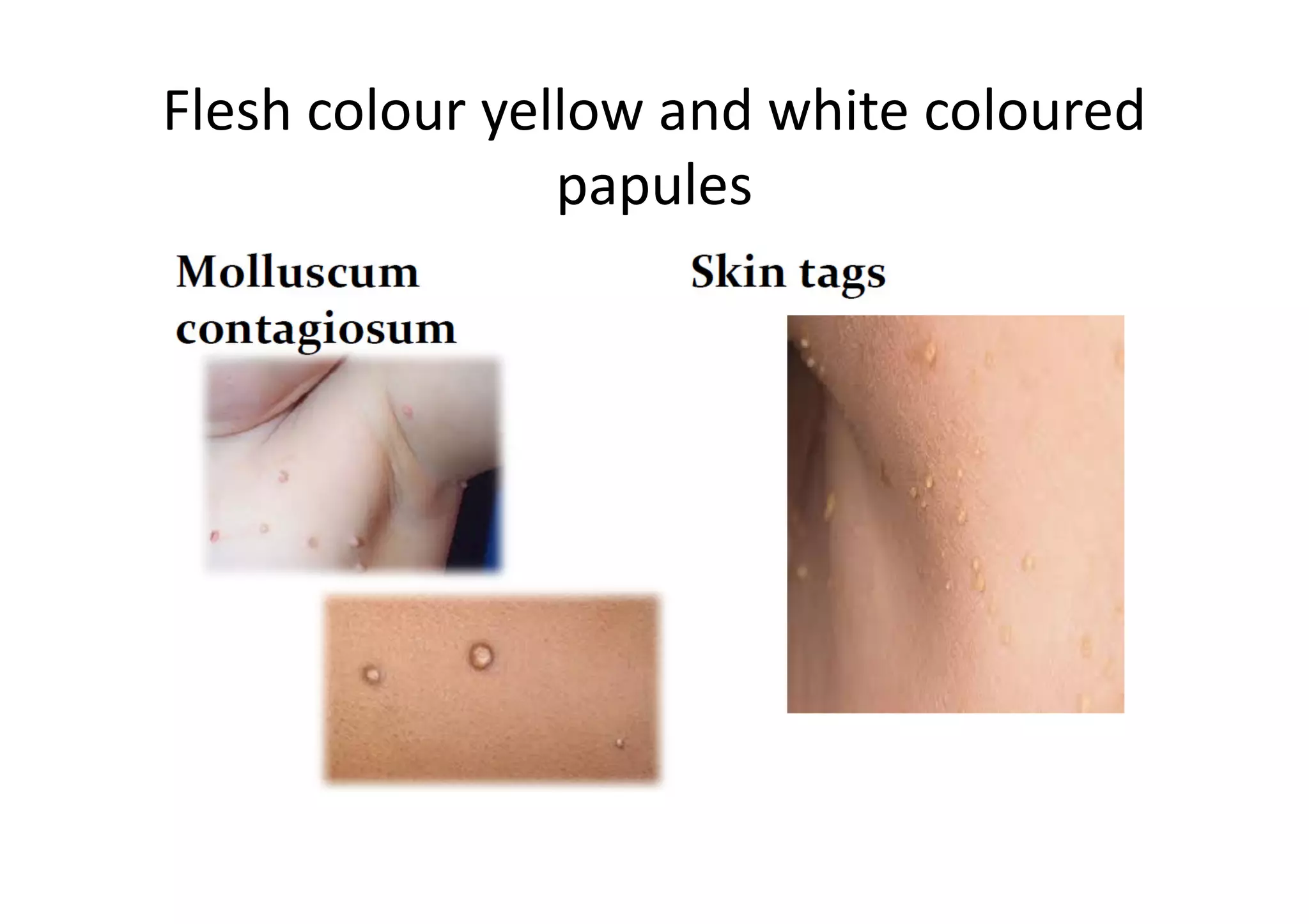 Classification of skin lesions pdf | PDF