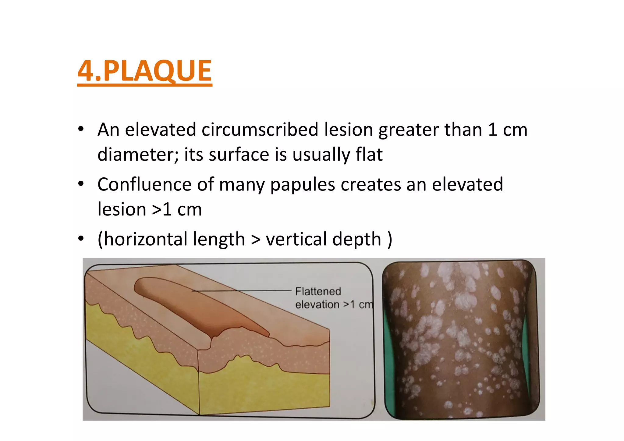 Classification of skin lesions pdf | PDF