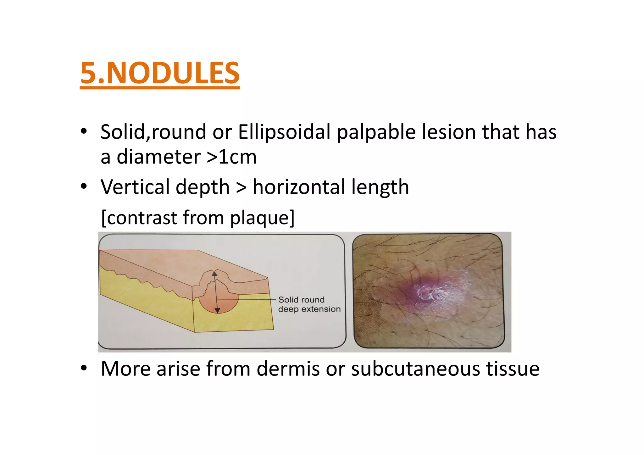 Classification of skin lesions pdf | PDF