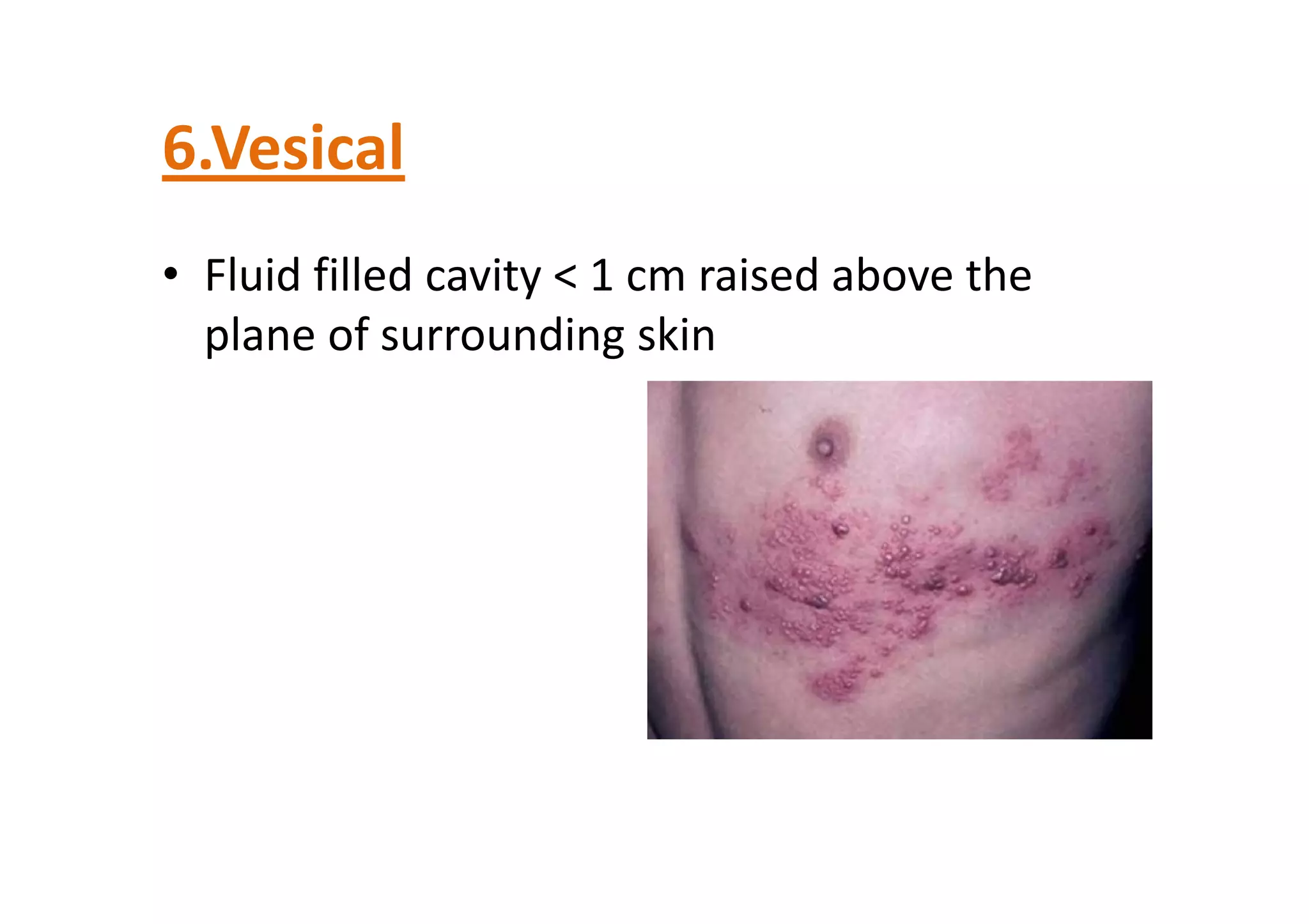 Classification of skin lesions pdf | PDF