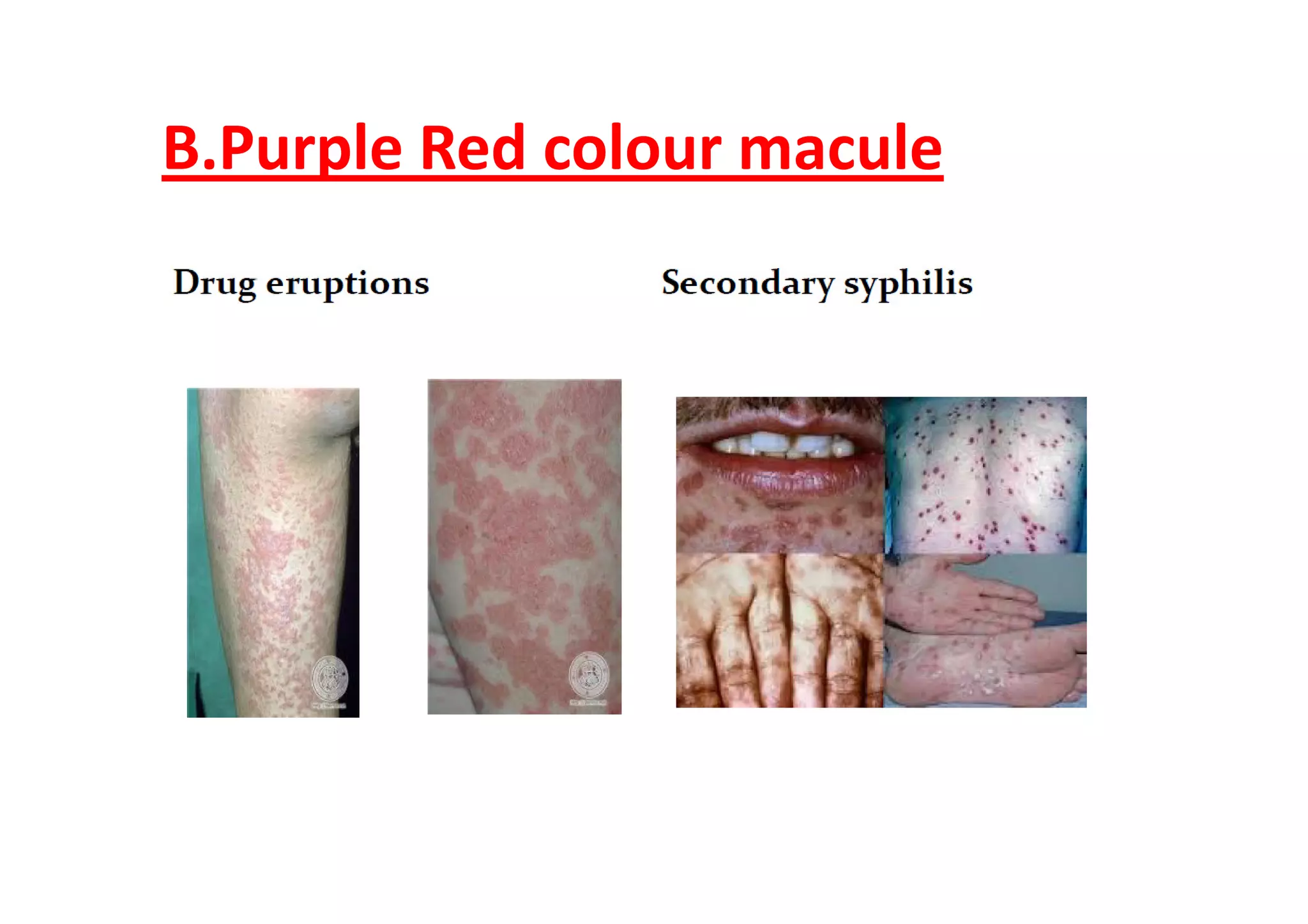 Classification of skin lesions pdf | PDF