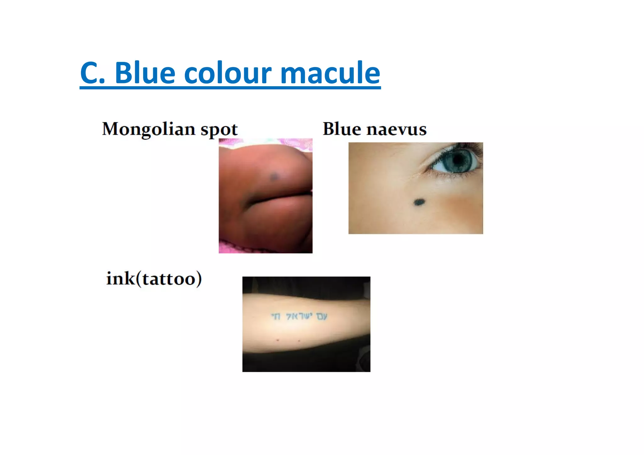 Classification of skin lesions pdf | PDF