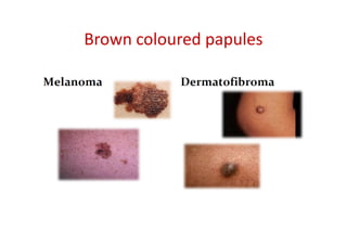 Classification of skin lesions pdf | PDF
