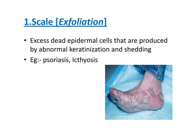 Classification of skin lesions pdf | PDF