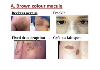 Classification of skin lesions pdf | PDF