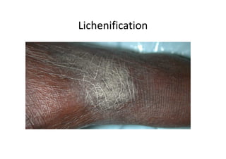 Classification of skin lesions pdf | PDF