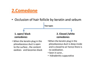 Classification of skin lesions pdf | PDF