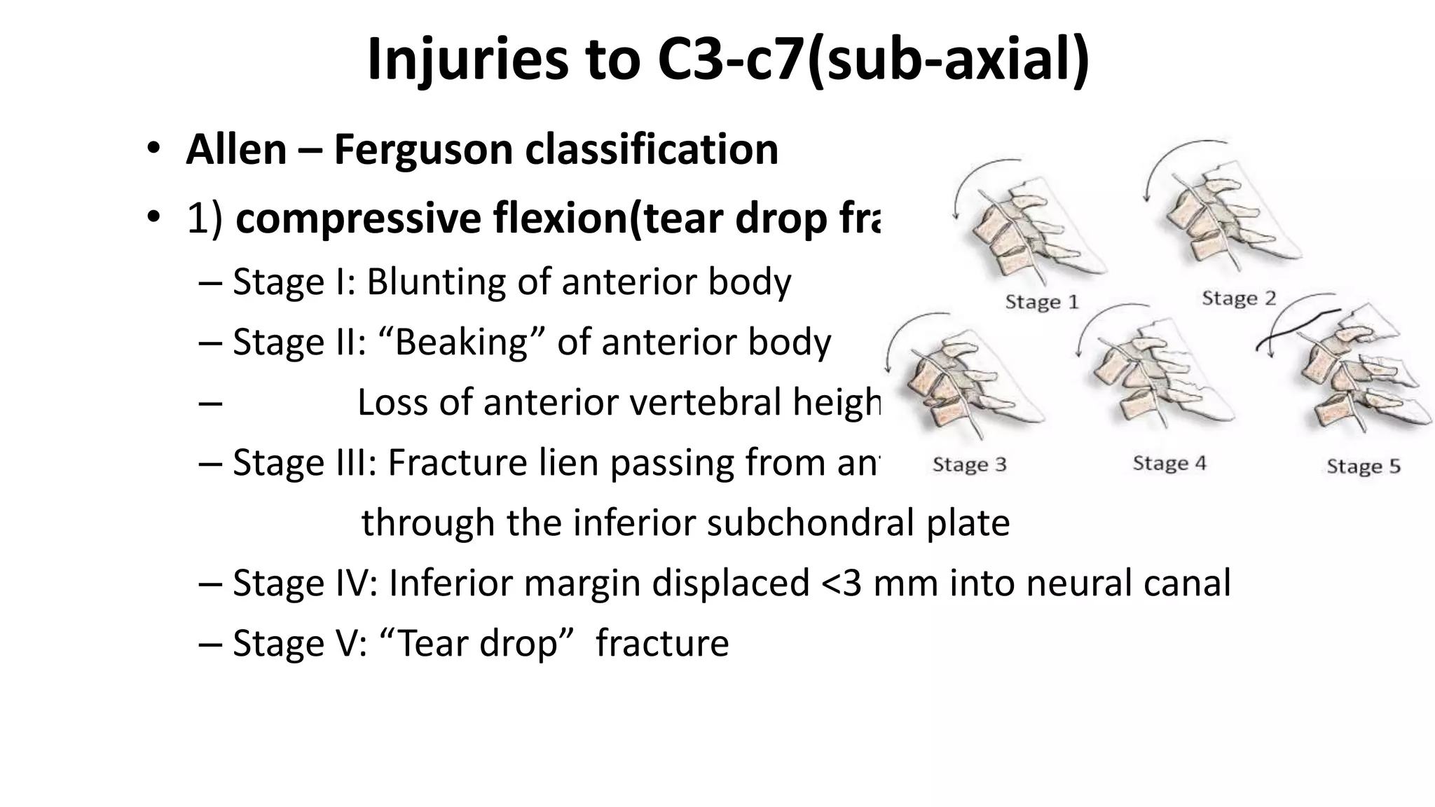 Classification of spinal fracture | PPTX