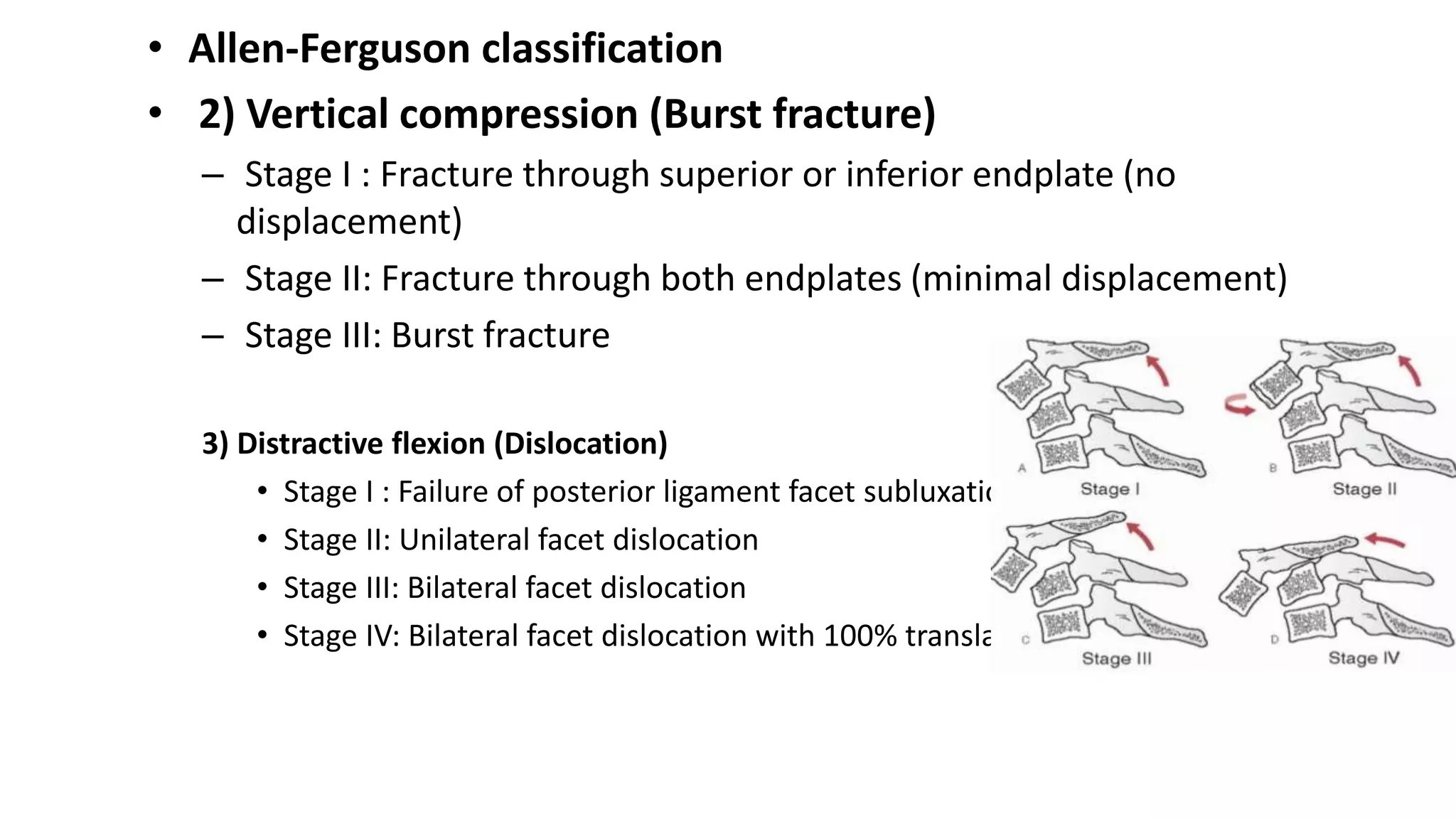 Classification of spinal fracture | PPTX