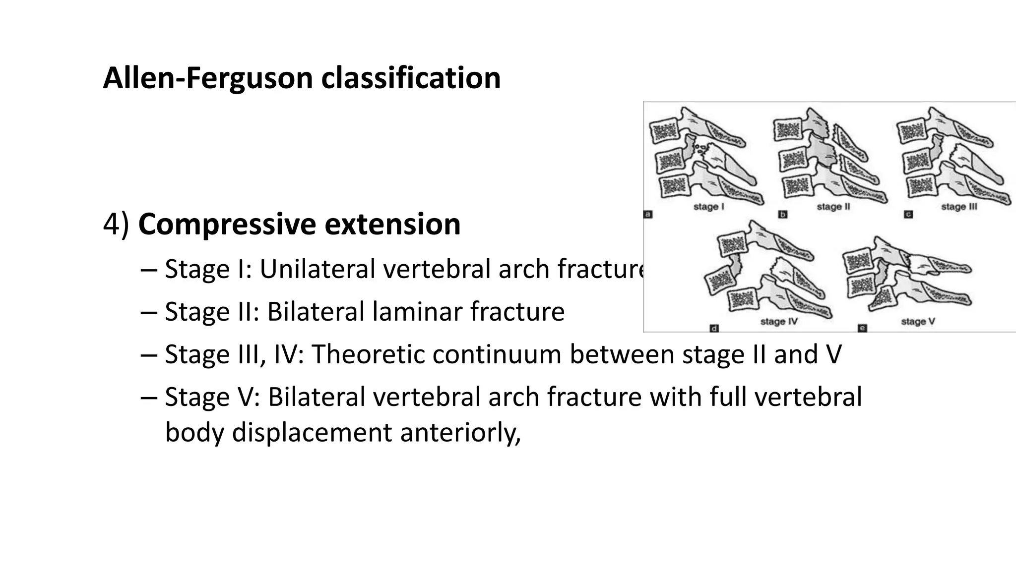 Classification of spinal fracture | PPTX