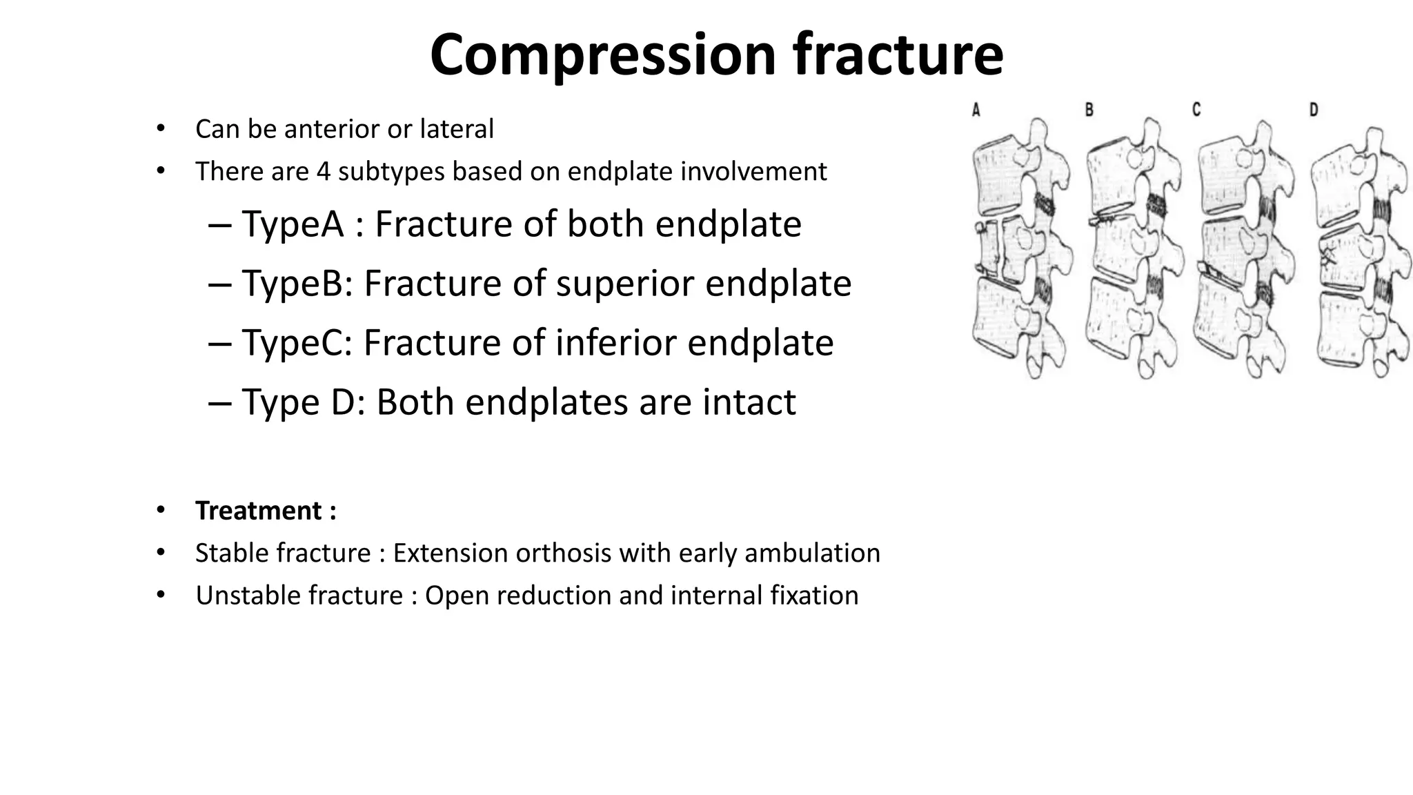 Classification of spinal fracture | PPTX