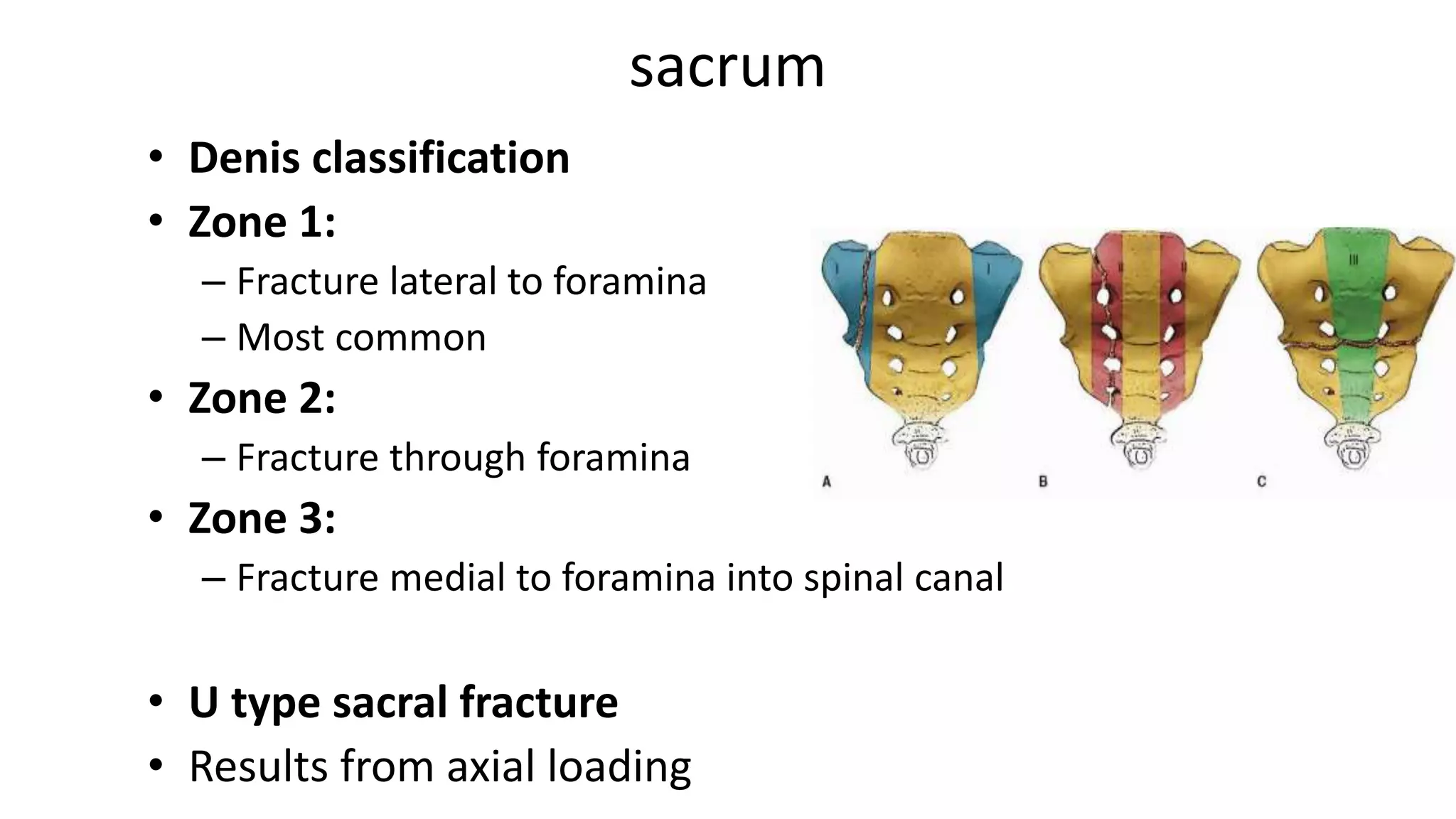 Classification of spinal fracture | PPTX