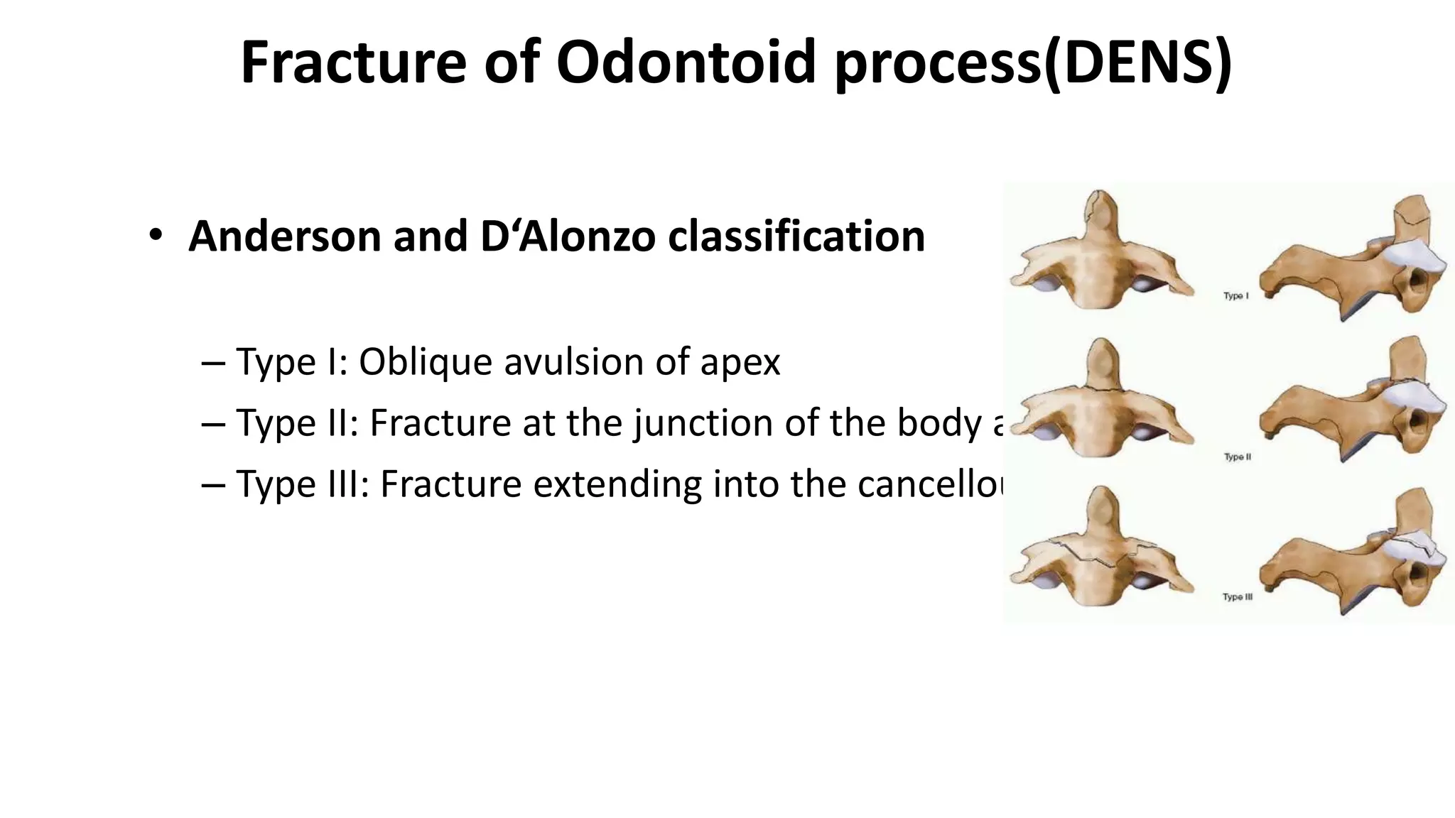 Classification of spinal fracture | PPTX