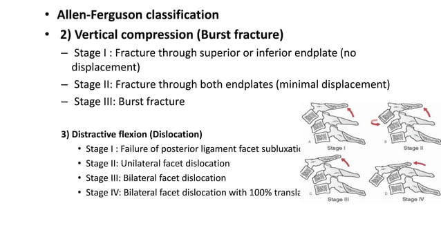 Classification of spinal fracture | PPTX | Death, Injury, or Military ...