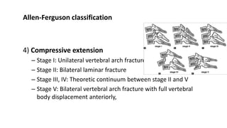 Classification of spinal fracture | PPTX