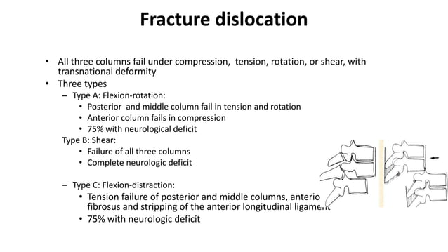 Classification of spinal fracture | PPTX | Death, Injury, or Military ...