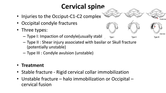 Classification of spinal fracture | PPTX | Death, Injury, or Military ...