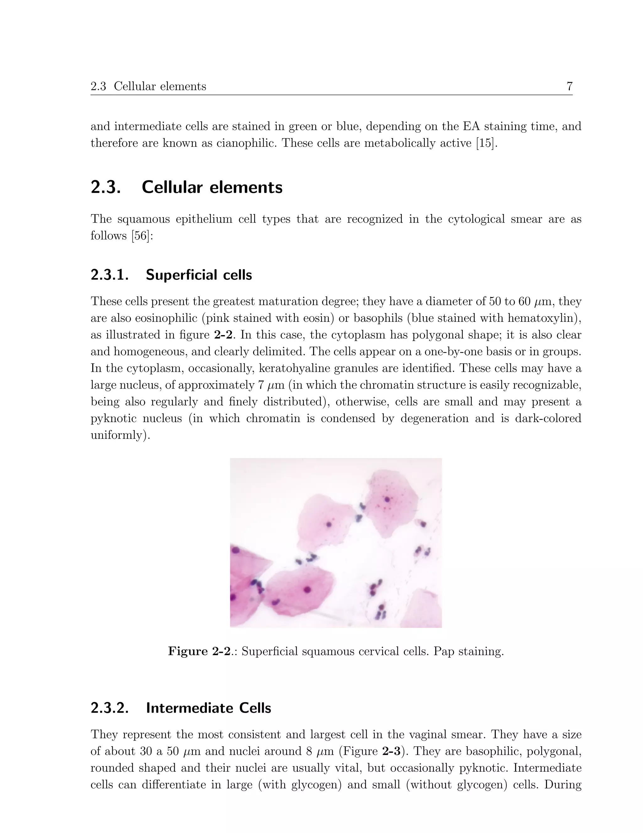 Classification of squamous cell cervical cytology | PDF