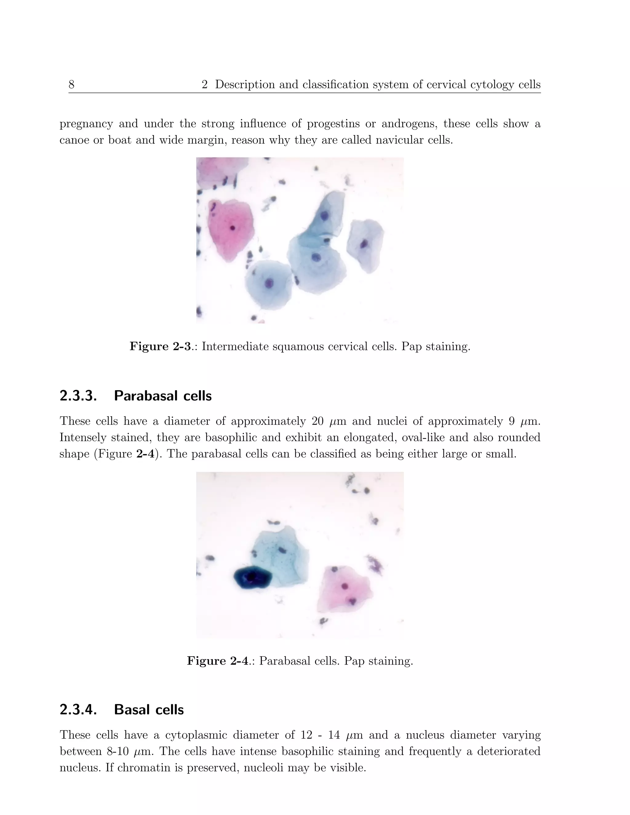 Classification of squamous cell cervical cytology | PDF