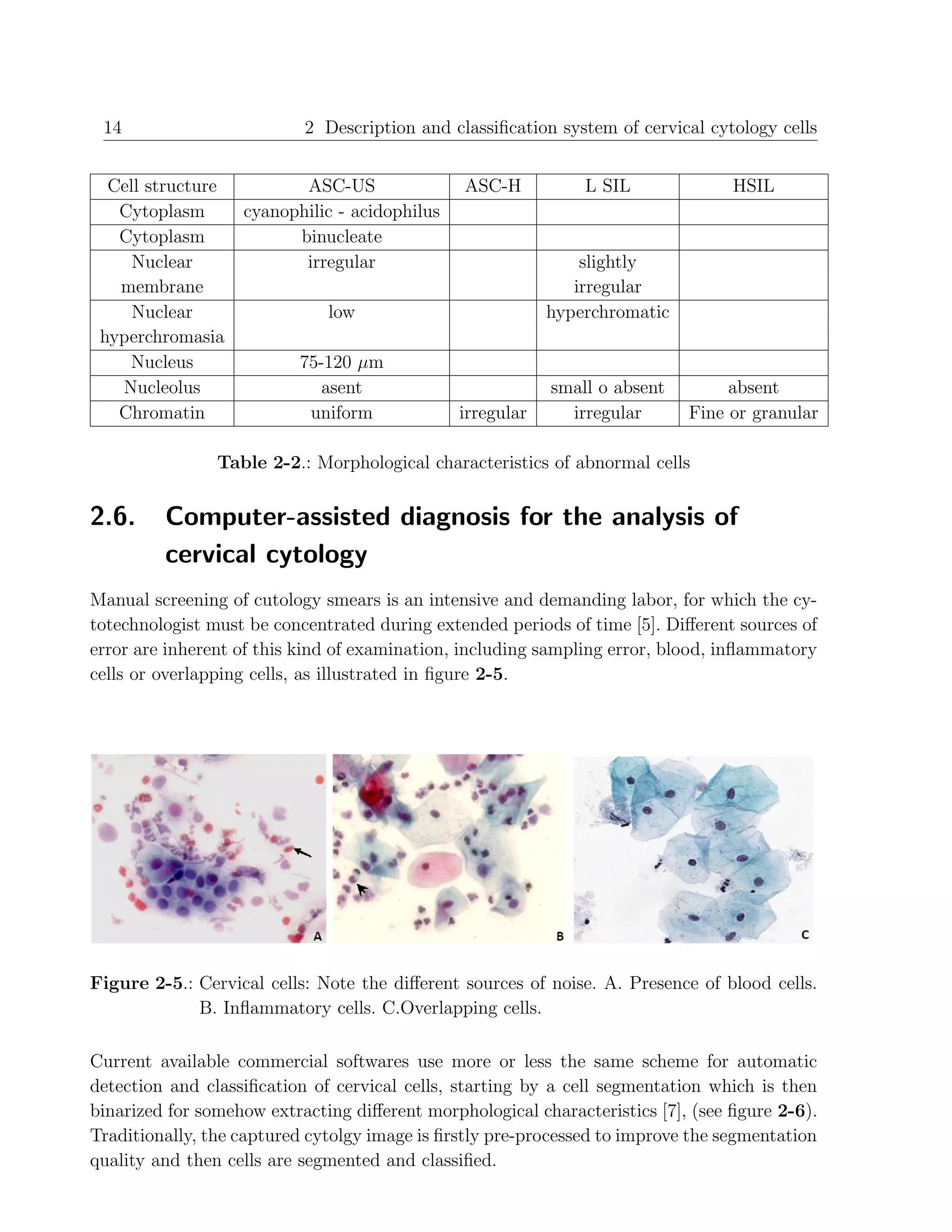 Classification of squamous cell cervical cytology | PDF