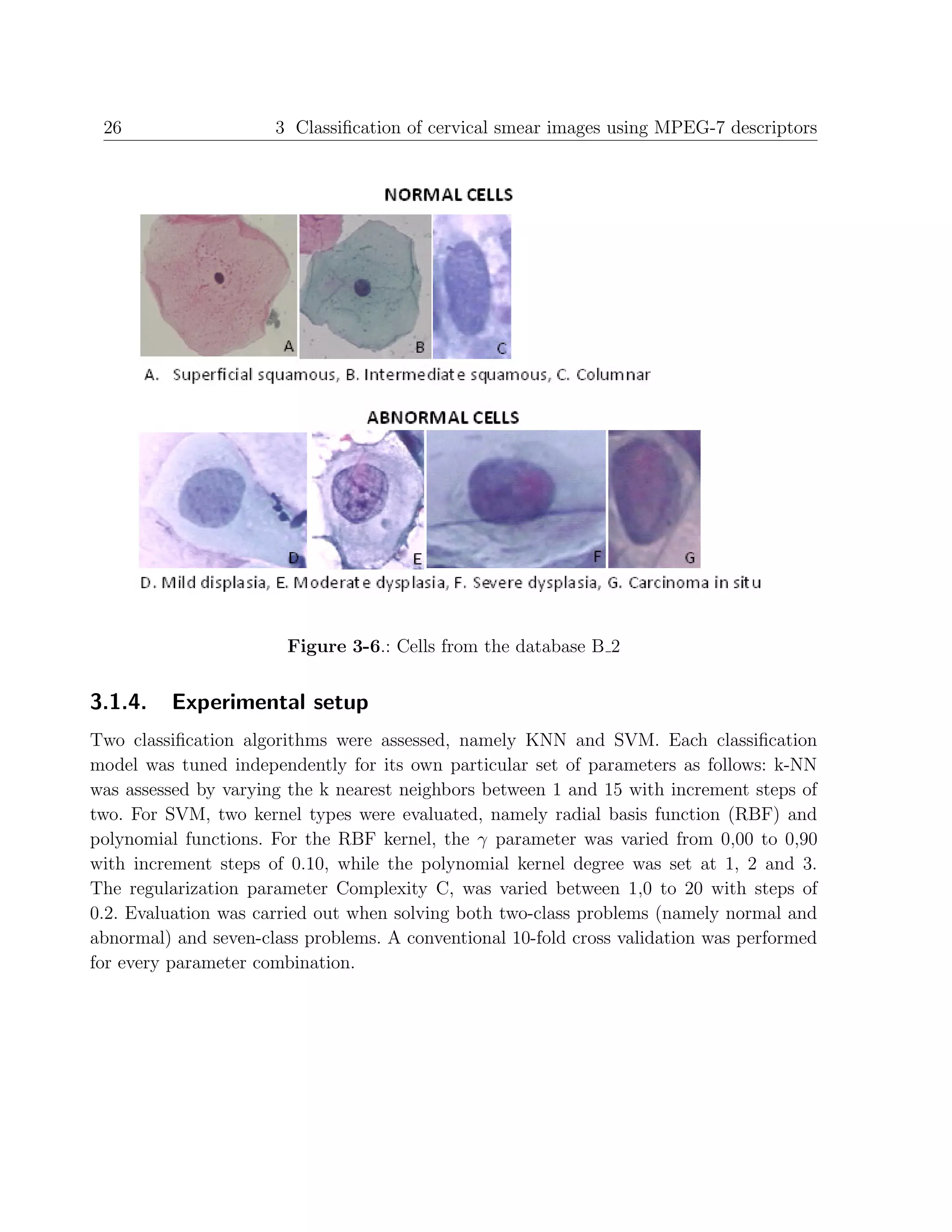 Classification of squamous cell cervical cytology | PDF