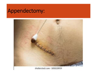 Classification of surgical wounds based on contamination | PPTX