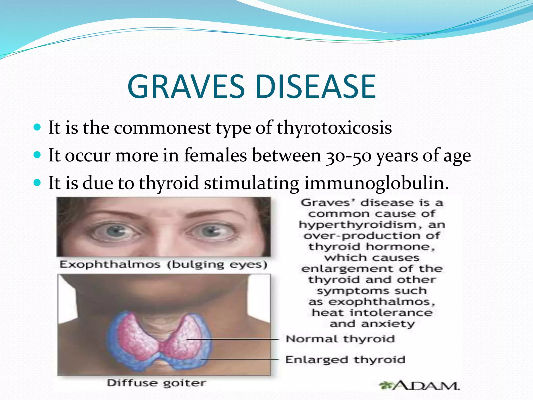 Classification of Thyroid Diseases | PPTX