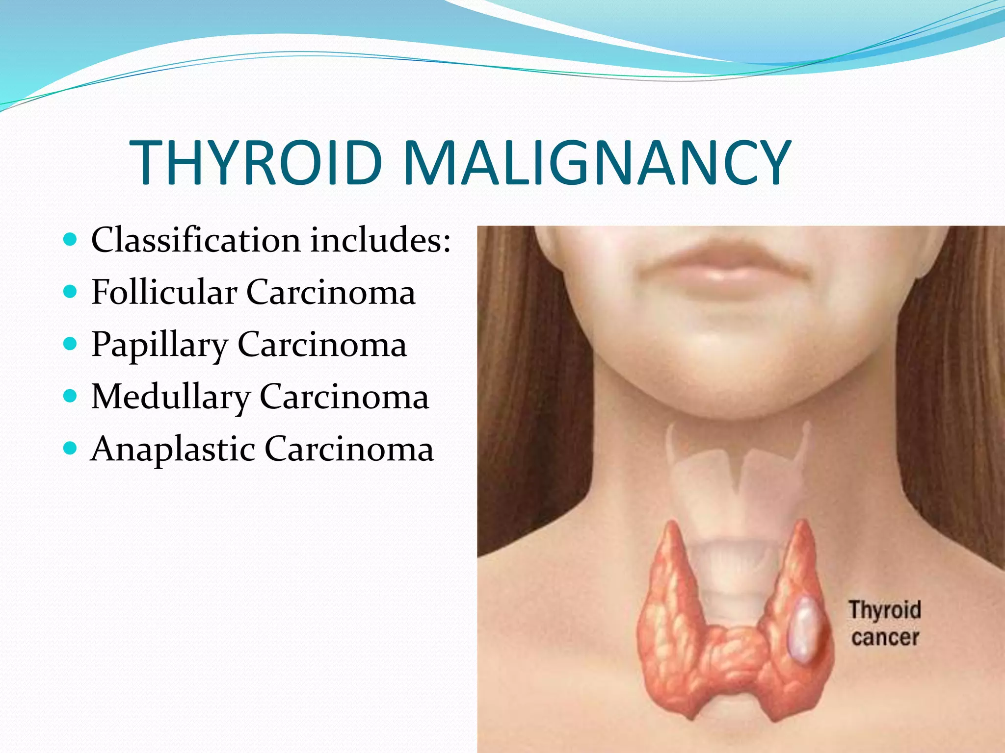 Classification of Thyroid Diseases | PPTX