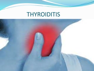 Classification of Thyroid Diseases | PPT