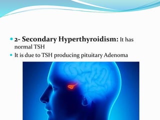 Classification of Thyroid Diseases | PPT