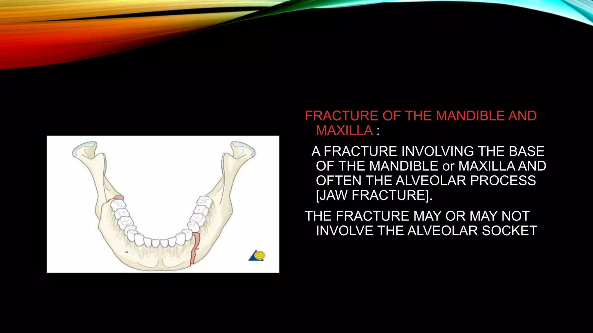 Classification of traumatic injuries to anterior teeth - andreasen's ...