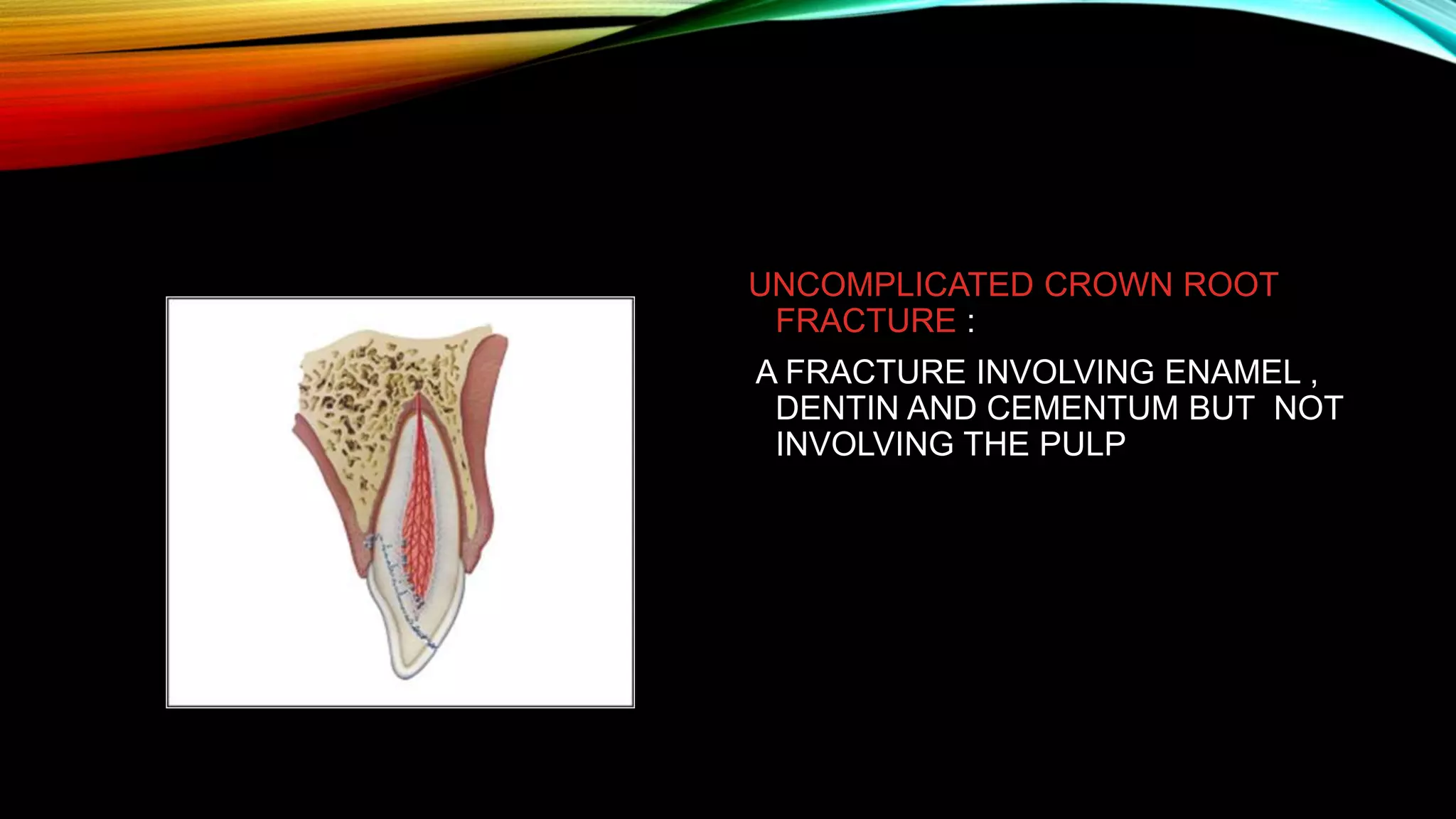 Classification of traumatic injuries to anterior teeth - andreasen's ...