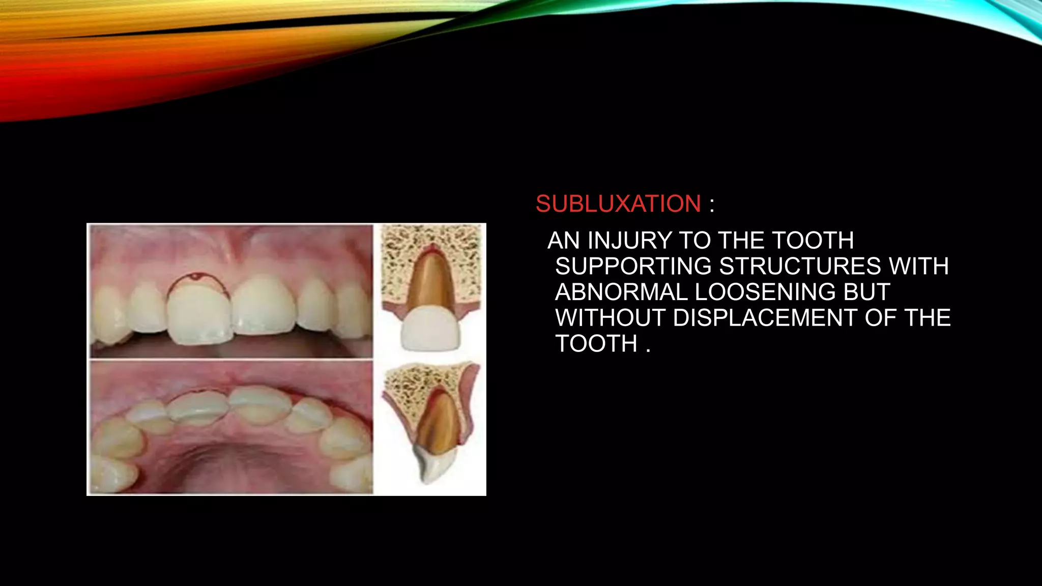 Classification of traumatic injuries to anterior teeth - andreasen's ...