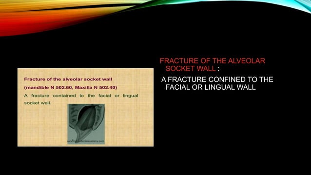 Classification of traumatic injuries to anterior teeth - andreasen's ...