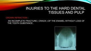 Classification of traumatic injuries to anterior teeth - andreasen's ...