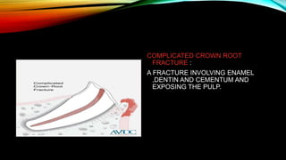 Classification of traumatic injuries to anterior teeth - andreasen's ...
