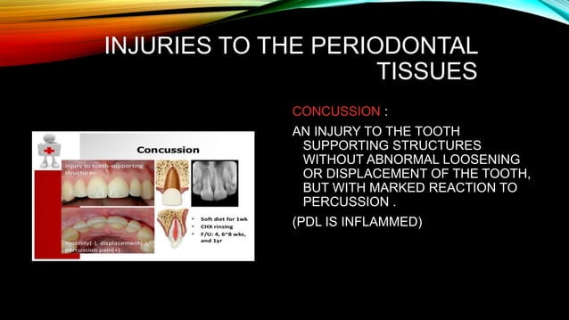 Classification of traumatic injuries to anterior teeth - andreasen's ...