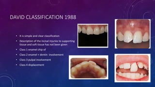 classification of traumatic injury of oral tissue.pptx