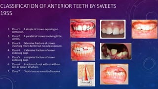 classification of traumatic injury of oral tissue.pptx