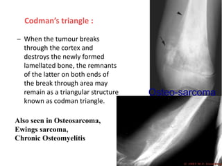 Classification of tumours and general principles of management of ...