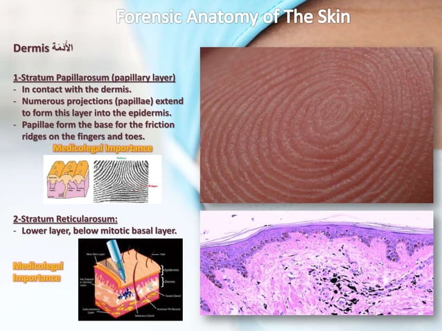Definitions, Biophysics and Classifications of wounding | PDF ...